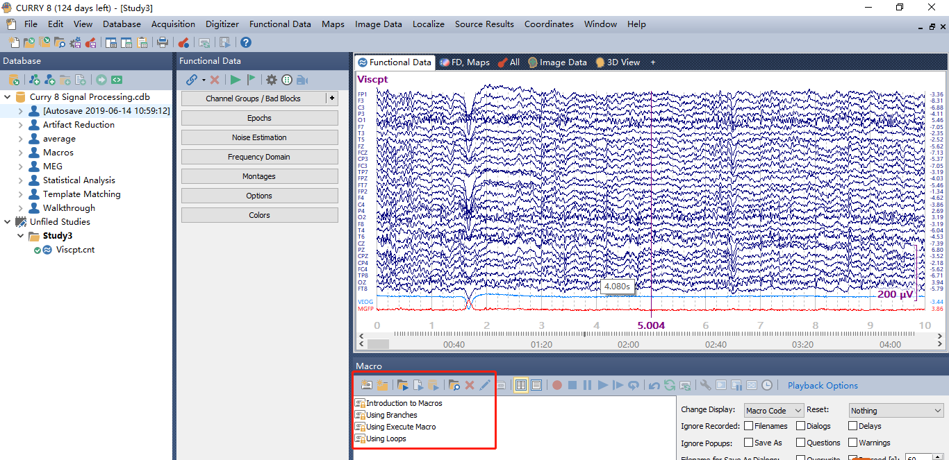 Neuroscan EEG/ERP系统_Neuroscan脑电_脑科学_脑电_生物力学_人因工程_人因工效_上海逢友信息科技有限公司