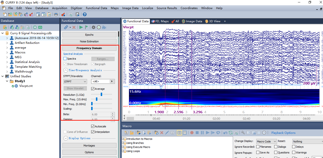 Neuroscan EEG/ERP系统_Neuroscan脑电_脑科学_脑电_生物力学_人因工程_人因工效_上海逢友信息科技有限公司