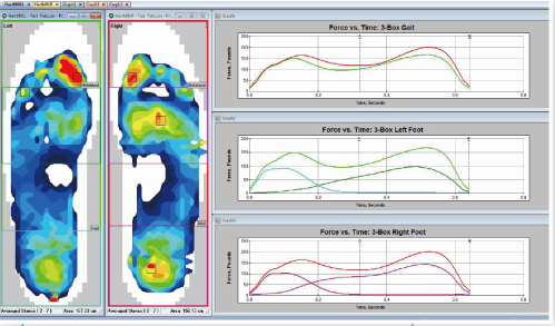 Tekscan_F-Scan_足底压力分布_压力分布_人因工效_fedu