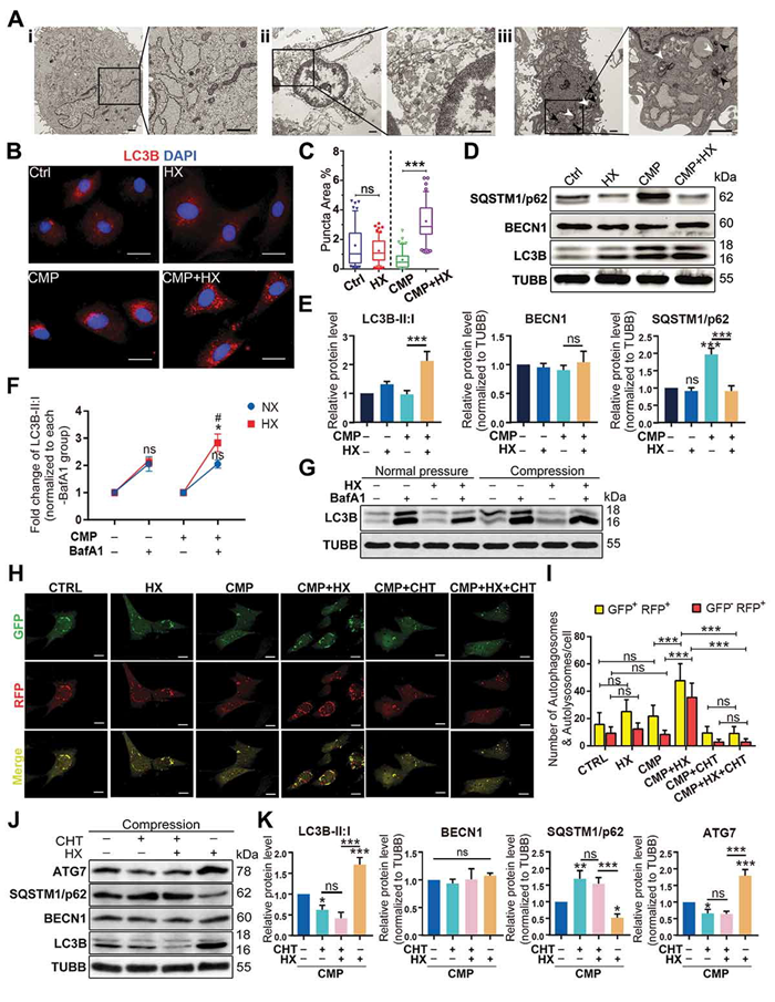 HIF1α通过上调自噬减缓压力诱导的髓核来源干细胞凋亡 - 企业动态 - 丁香通