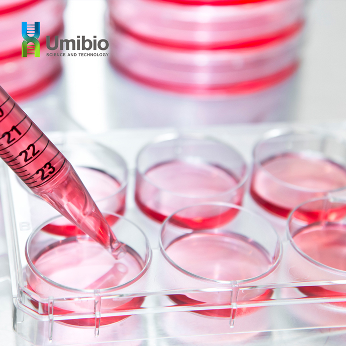 Exosome Extraction and Purification Kit (Cell Supernatant)_Shanghai ...