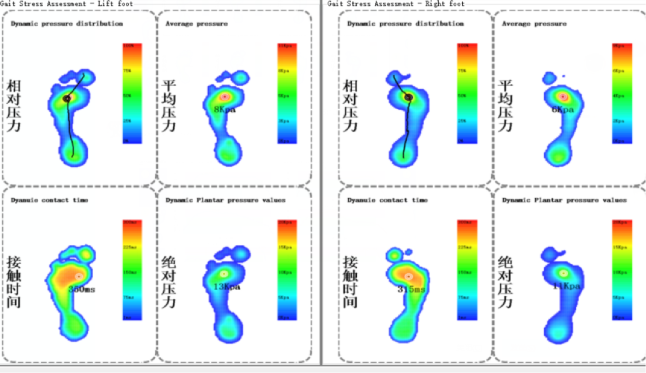 福建省某**医院引进芯康生物®（MedTrack®）步态分析系统助力推进康复理疗新模式 _明升禾科技（北京）有限公司