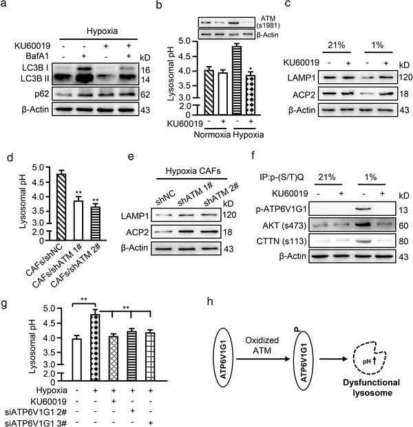 缺氧诱导的ATM激活调节自噬相关外泌体从癌症相关成纤维细胞中释放以促进癌细胞侵袭-研载生物科技（上海）有限公司
