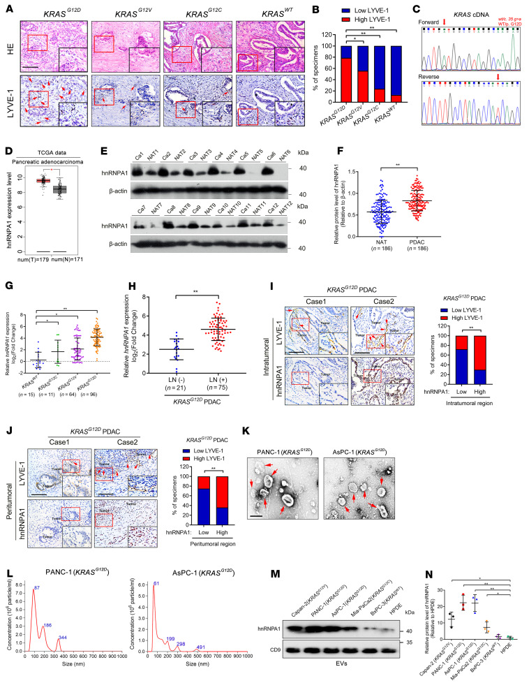 【JCI】19分+，外泌体在KRAS突变体驱动的胰腺癌淋巴结转移中的作用机制研究 - 企业动态 - 丁香通