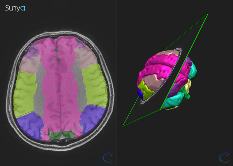 CT医学影像三维重建服务-位姿科技