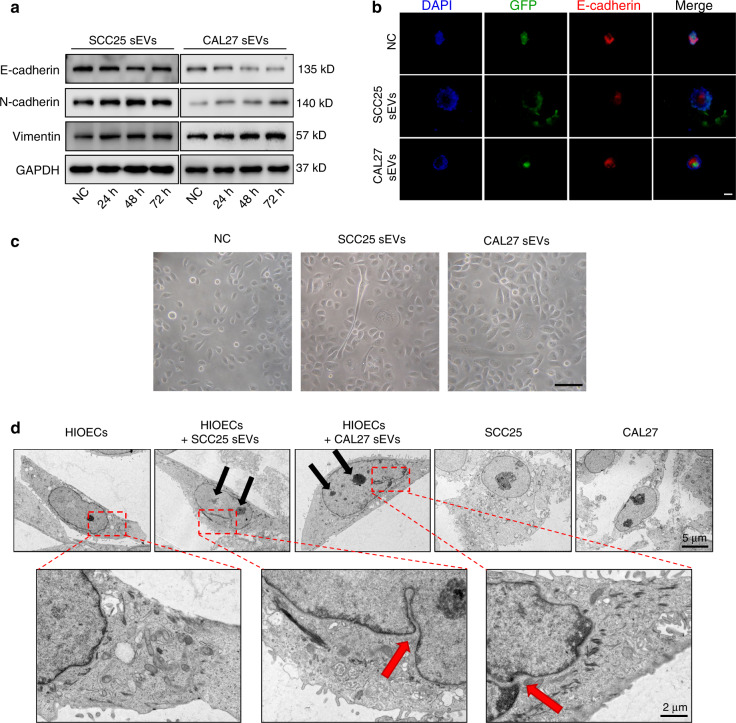 癌细胞通过富含miR-let-7c的小细胞外囊泡介导的p53/PTEN下调破坏正常上皮细胞-研载生物科技（上海）有限公司