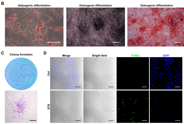 凋亡小泡激活受体细胞中的自噬以诱导血管生成和牙髓再生-研载生物科技（上海）有限公司