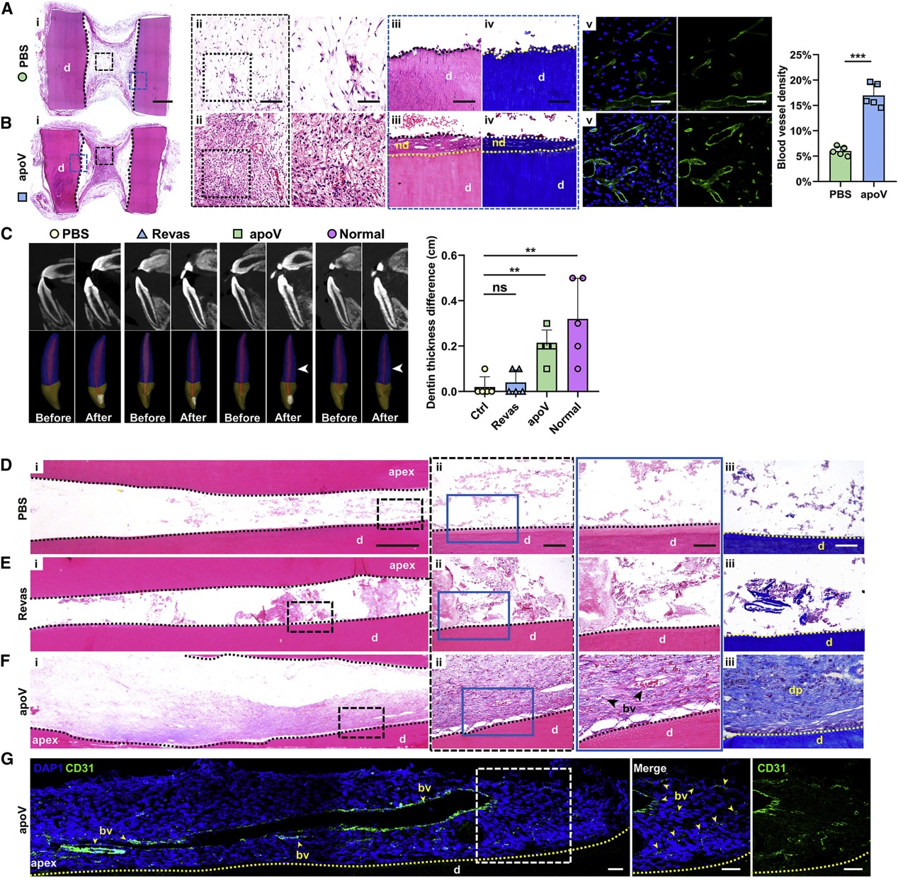 凋亡小泡激活受体细胞中的自噬以诱导血管生成和牙髓再生-研载生物科技（上海）有限公司