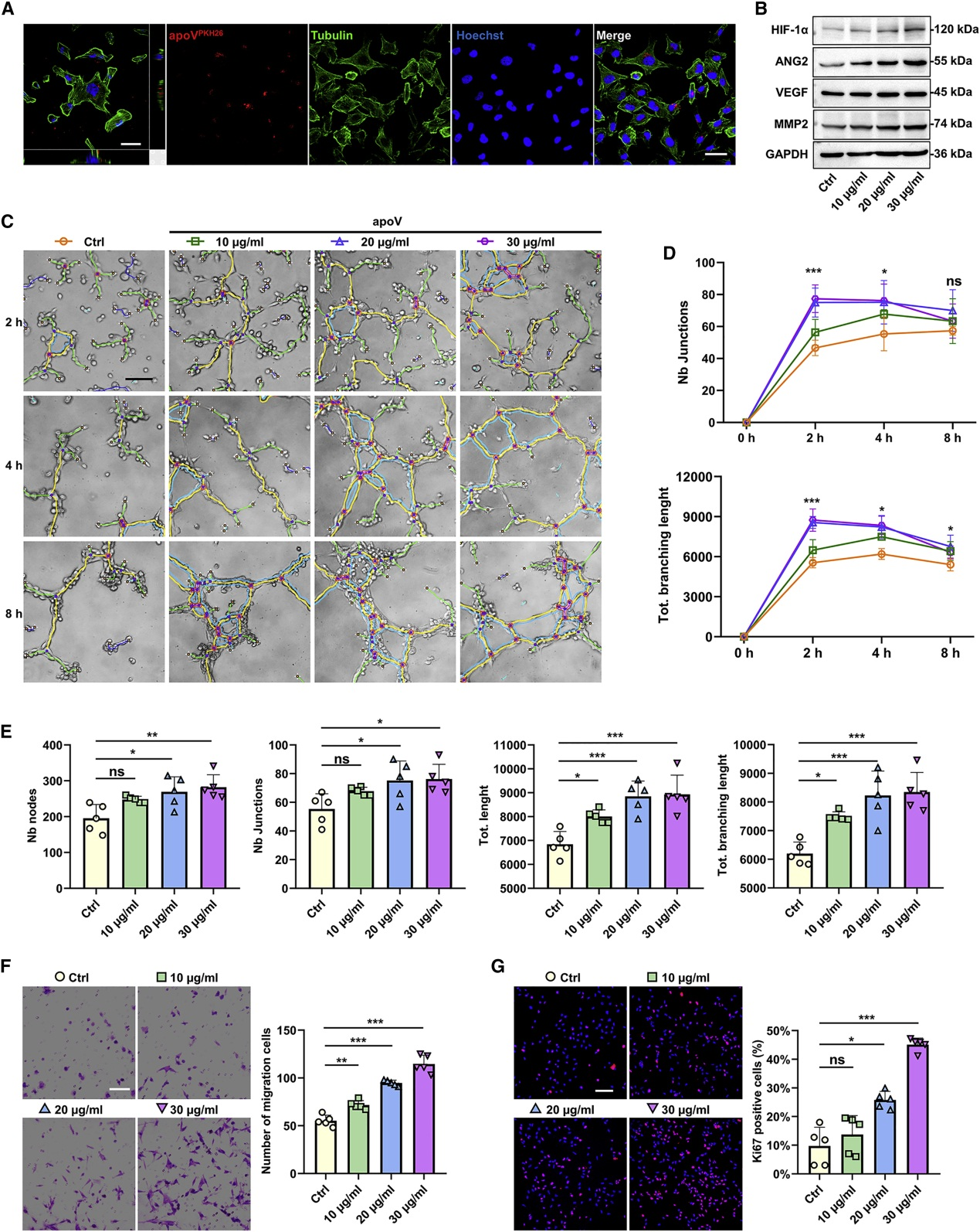 凋亡小泡激活受体细胞中的自噬以诱导血管生成和牙髓再生-研载生物科技（上海）有限公司