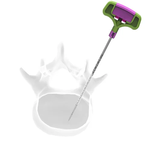 Kyphoplasty Tools Supplier/Factory Provide Kyphoplasty Tools-Inature