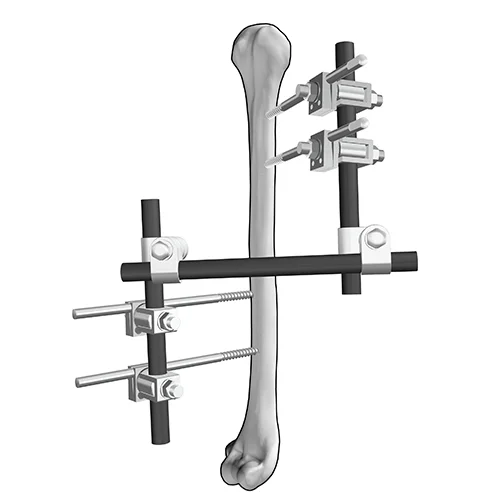 Cross Elbow Spanning External Hinged Movement Fixator Inature