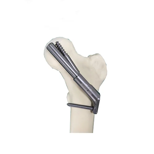 Femoral Recon/Intramedullary Nail System Factory/Oem-Inature