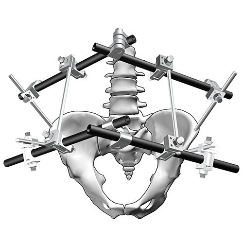 Pelvis And Hip External Fixator Pelvis Price/Supplier-Inature