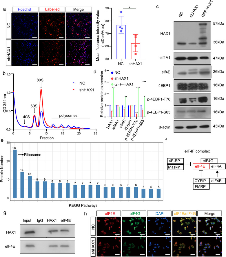 【J Extracell Vesicles】17分+，富含HAX1的细胞外囊泡通过调节ITGB6翻译促进血管生成 - 企业动态 - 丁香通