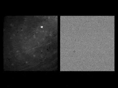 小鼠视网膜神经节细胞GCaMP钙离子成像_东方闪光（北京）光电科技有限公司