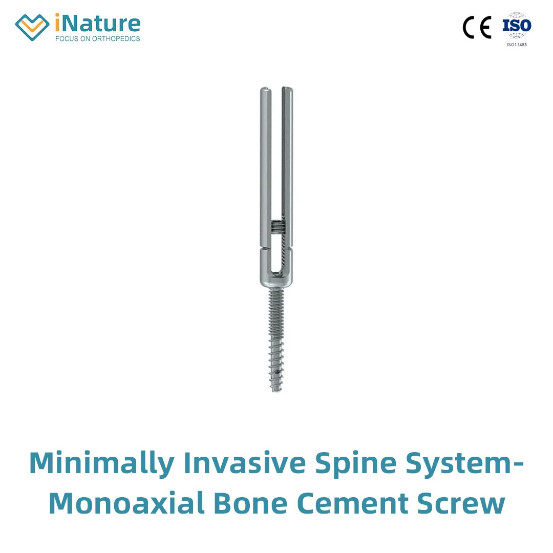 Minimally Invasive Spine System-Bone Cement Screw-| iNature ...