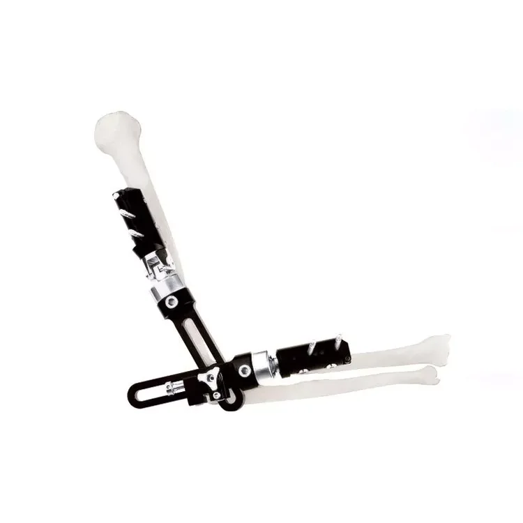 Cross Elbow Spanning External Hinged Movement Fixator Inature