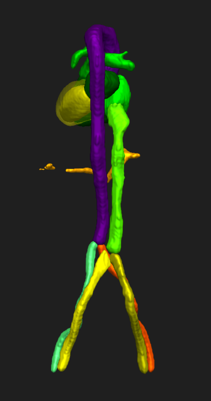 CT医学影像三维重建服务-位姿科技