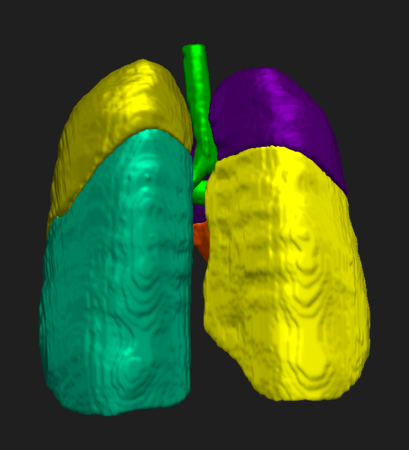 CT医学影像三维重建服务-位姿科技