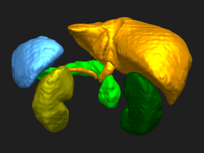 CT医学影像三维重建服务-位姿科技