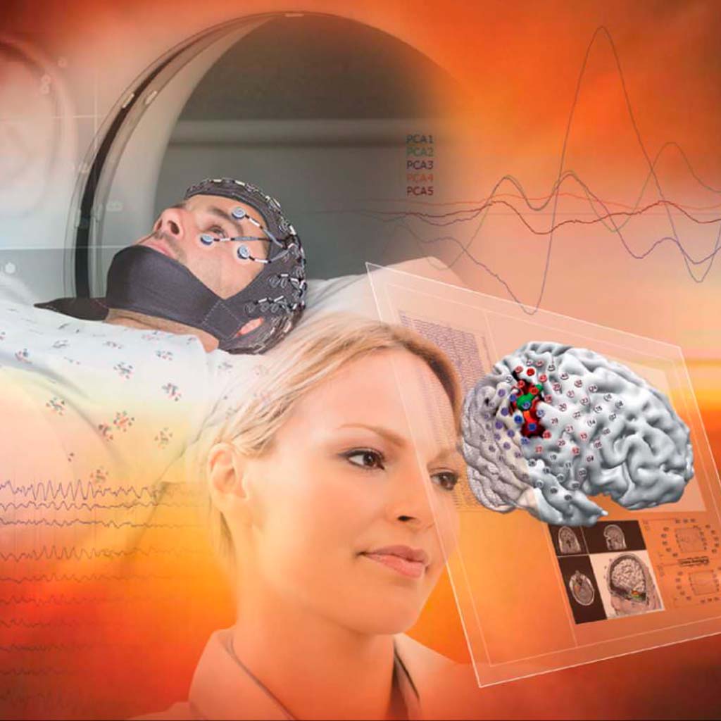 Neuroscan 64-256导脑电仪（事件相关电位系统）-上海形宙数字技术有限公司