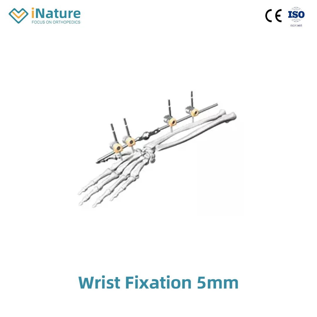 Wrist And Hand External Fixation Factory/Surgery-Inature