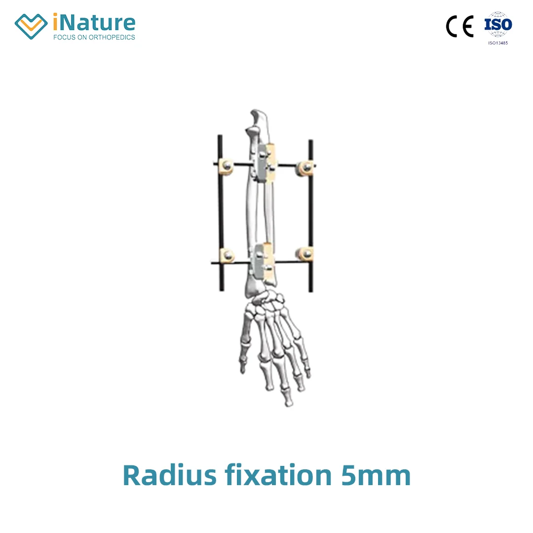 Wrist And Hand External Fixation Factory/Surgery-Inature