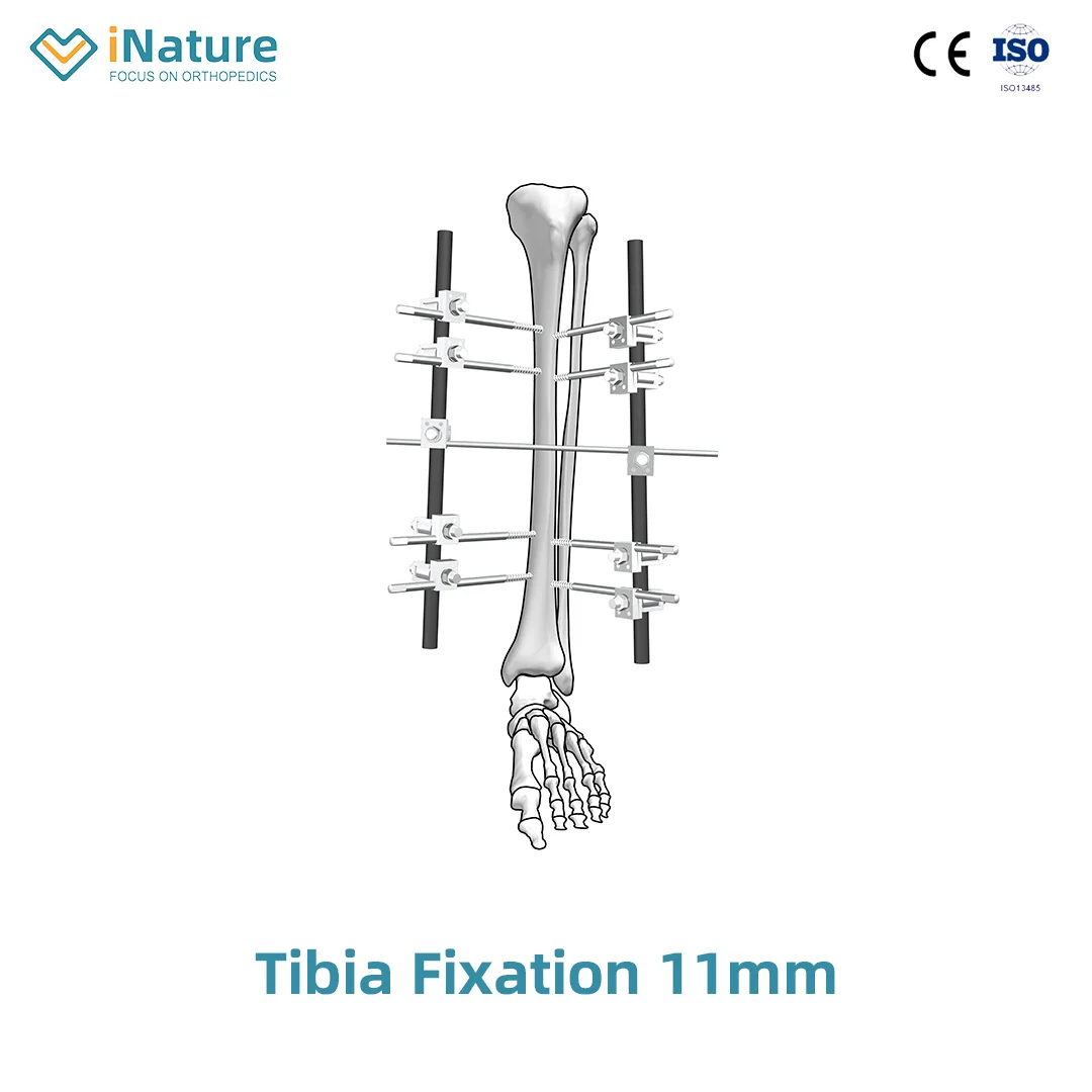 External Fixation Tibia Manufacturer/Price For Surgery-Inature