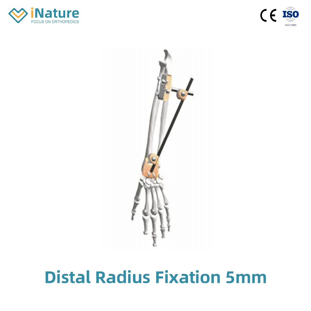 Wrist And Hand External Fixation Factory/Surgery-Inature