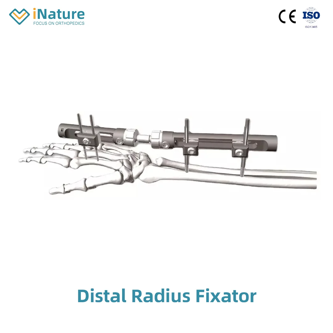 Wrist And Hand External Fixation Factory/Surgery-Inature