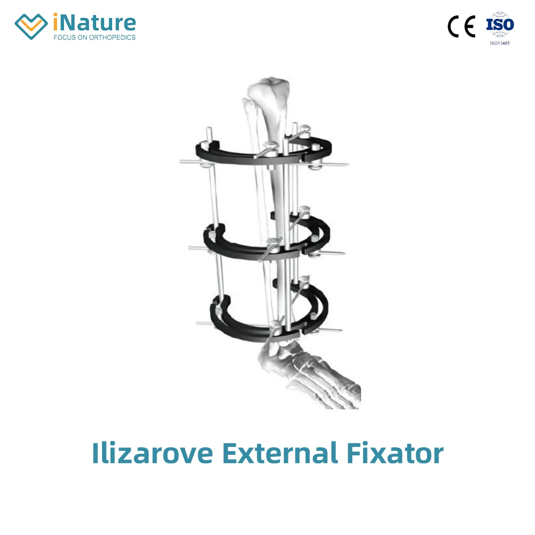 Unilateral External Fixation System Inature Manufacturer And Sale