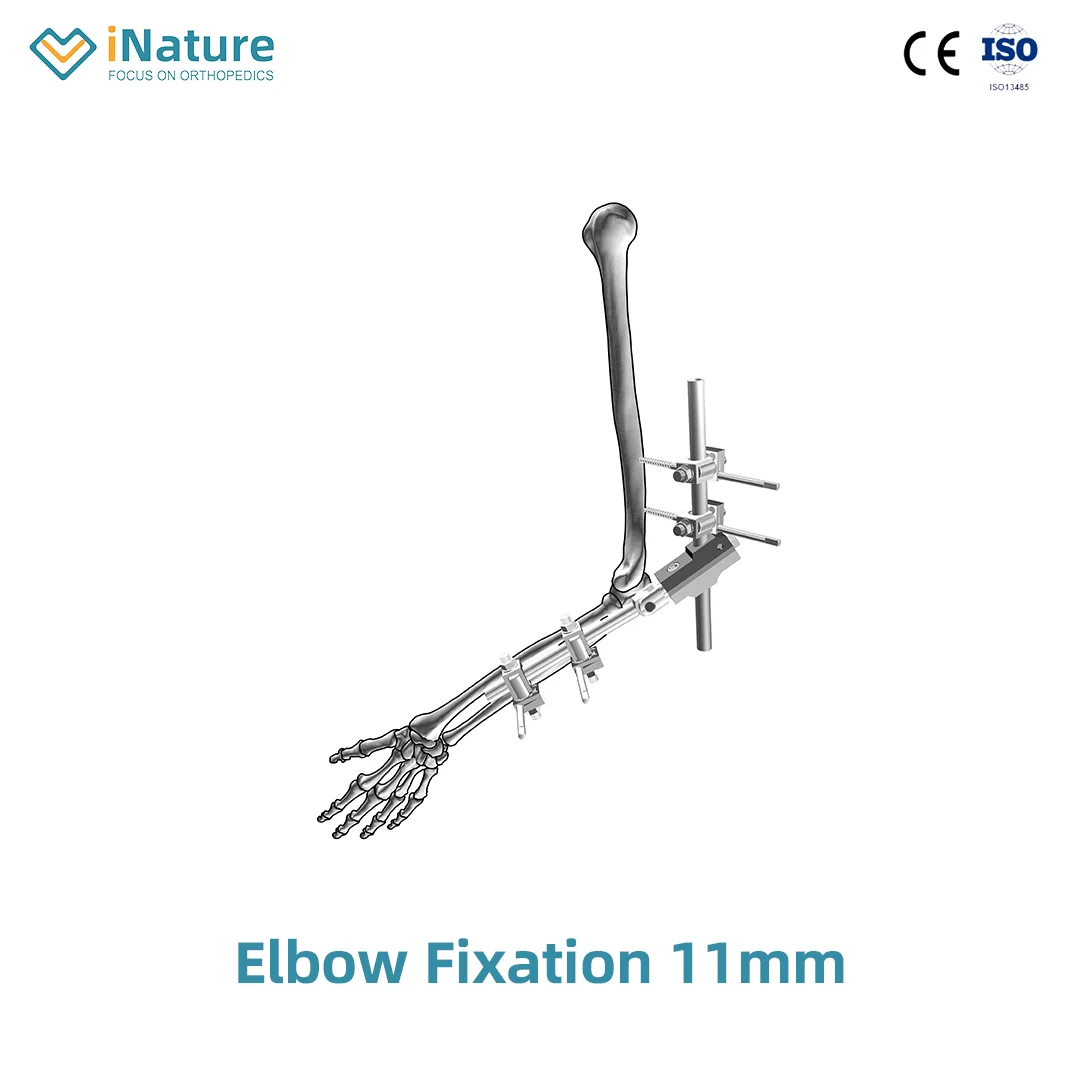 Φ11 0 Series External Fixation Fixator Inature Manufacturer And Sale