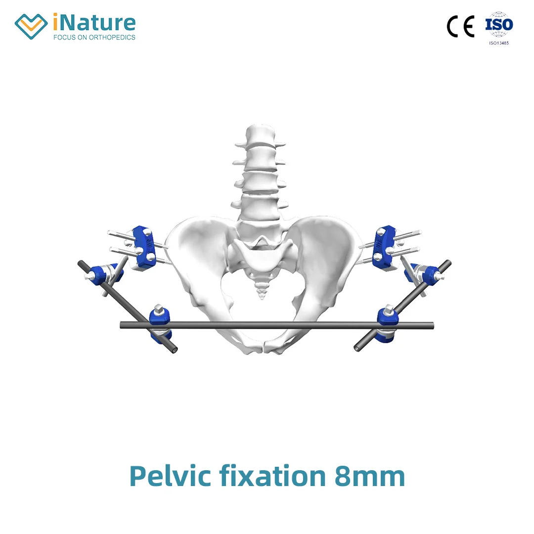 Pelvis And Hip External Fixator Pelvis Price/Supplier-Inature