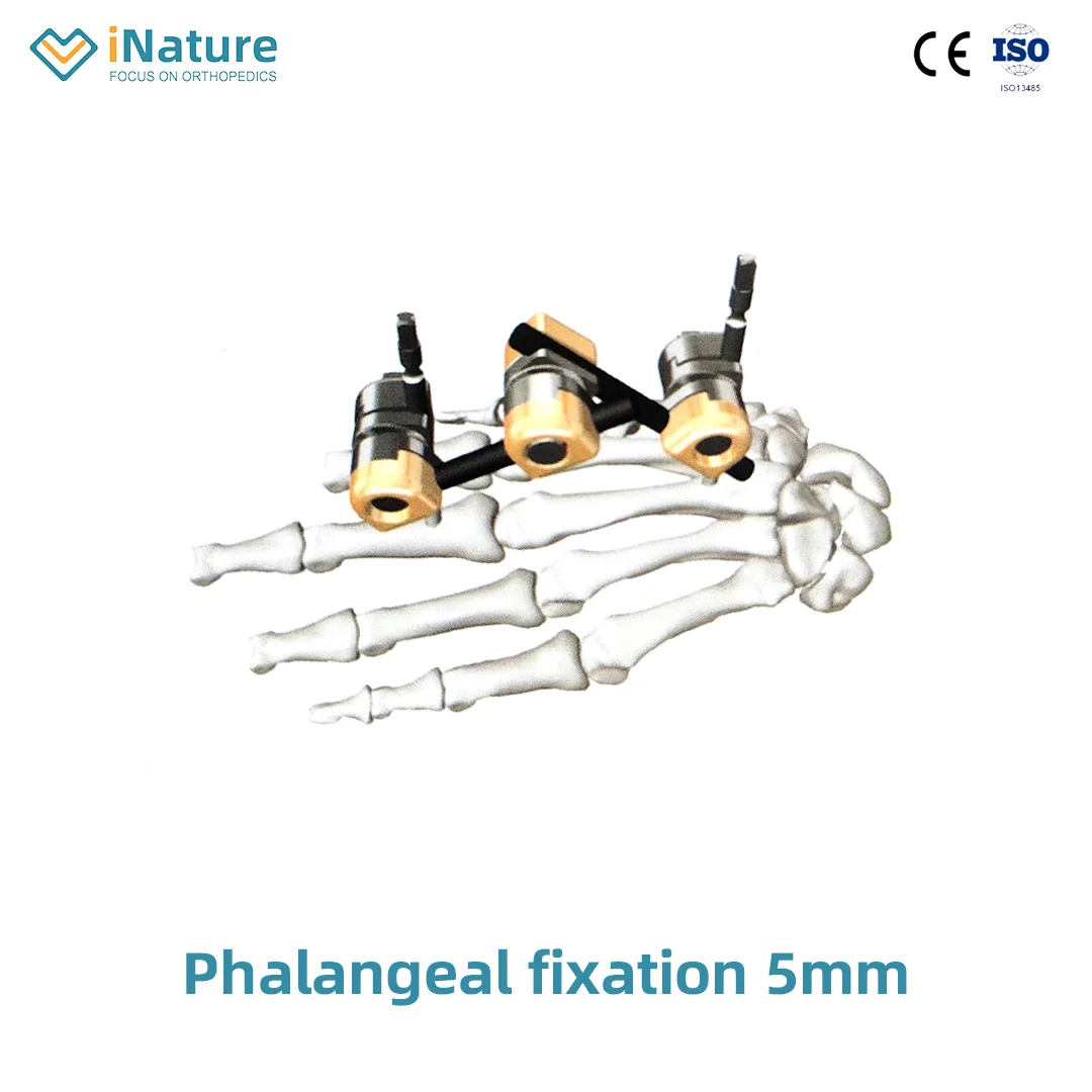 Wrist And Hand External Fixation Factory/Surgery-Inature