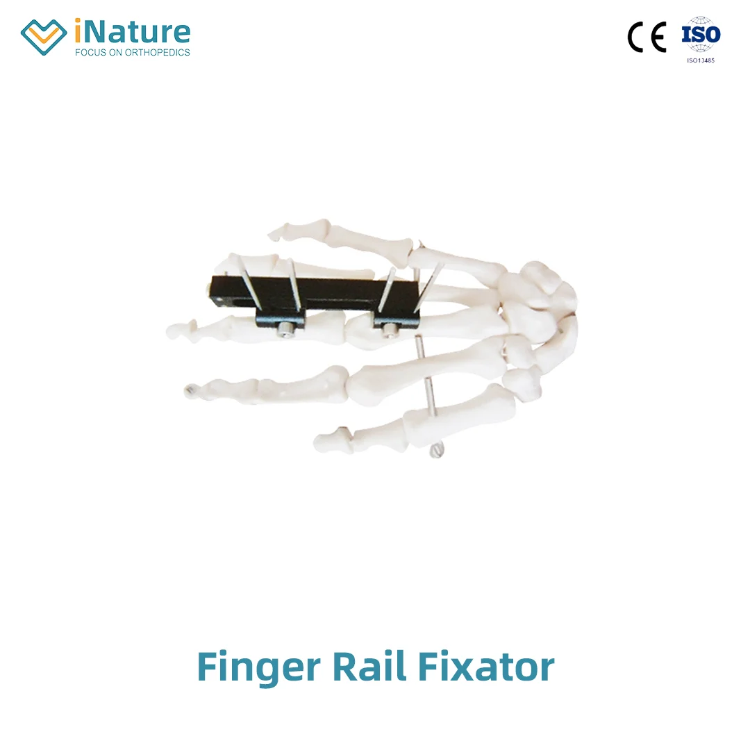 Wrist And Hand External Fixation Factory/Surgery-Inature
