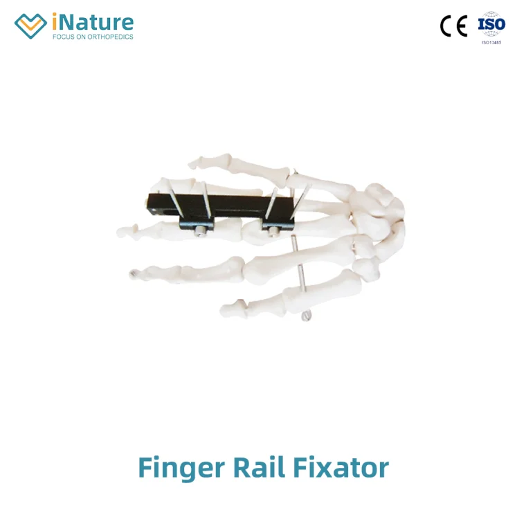 External Fixation System-iNature