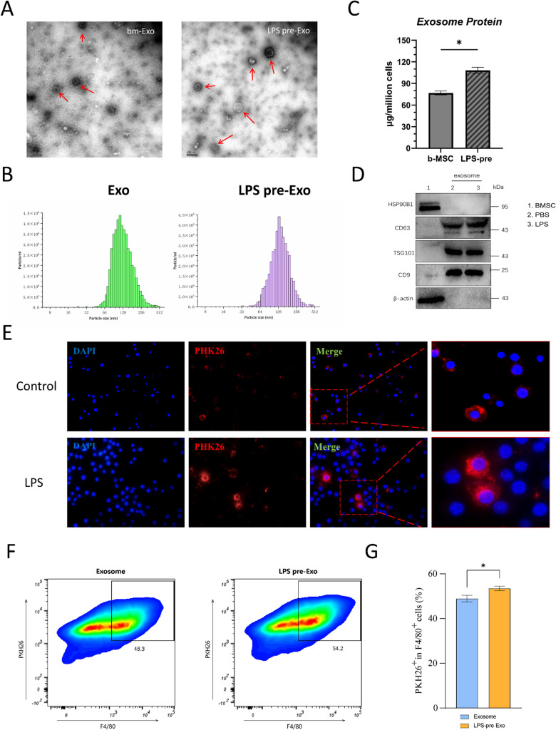 【J Nanobiotechnology】10+，LPS预处理的MSC来源外泌体通过NF- κ B/NLRP3信号通路调节巨噬细胞可塑性，促进 ...