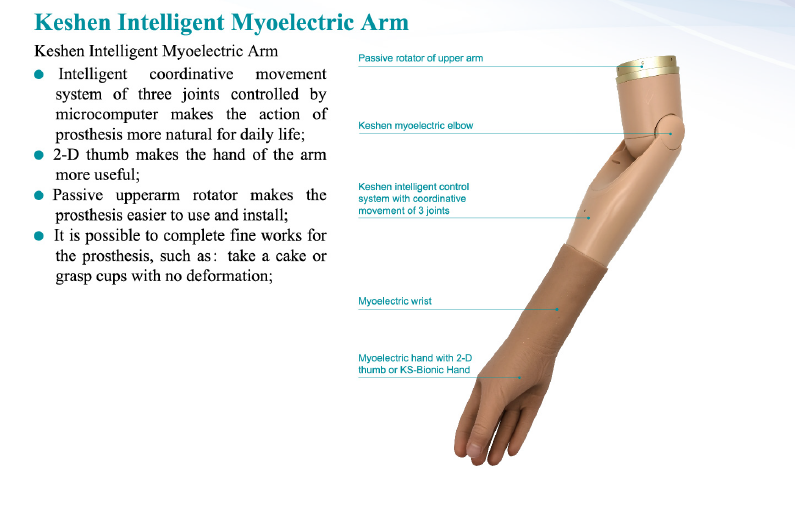 Keshen Intelligent Myoelectric Arm-Shanghai Kesheng Prosthetic ...