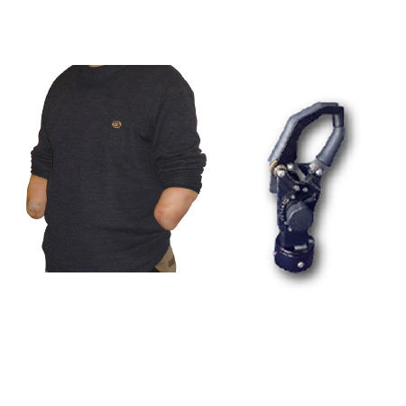 Electric Hand With Two Degrees Of Freedom (Wrist Flexion And Extension)