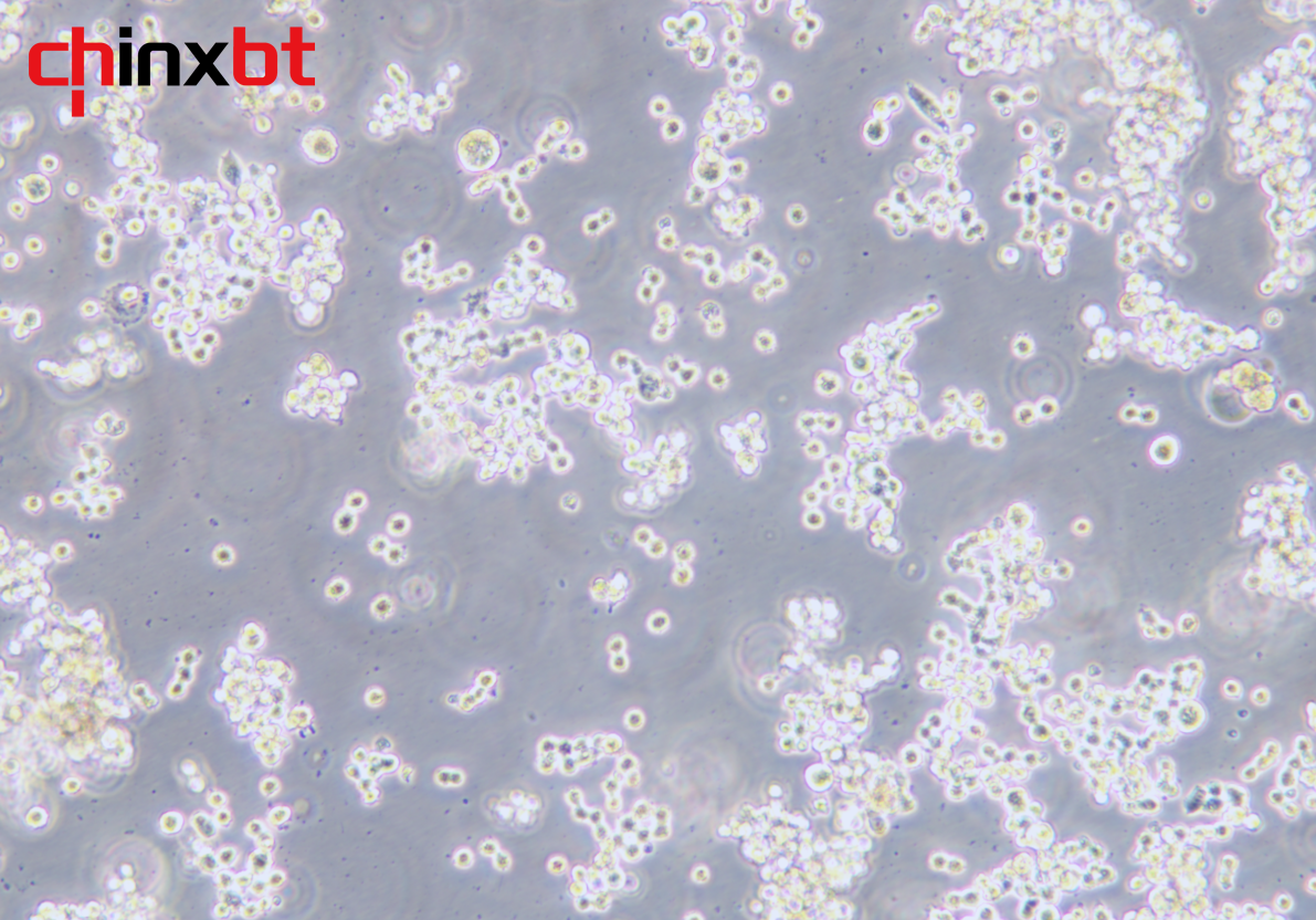 COLO320 HSR 人结直肠腺癌细胞_南京中欣博泰生物技术有限公司