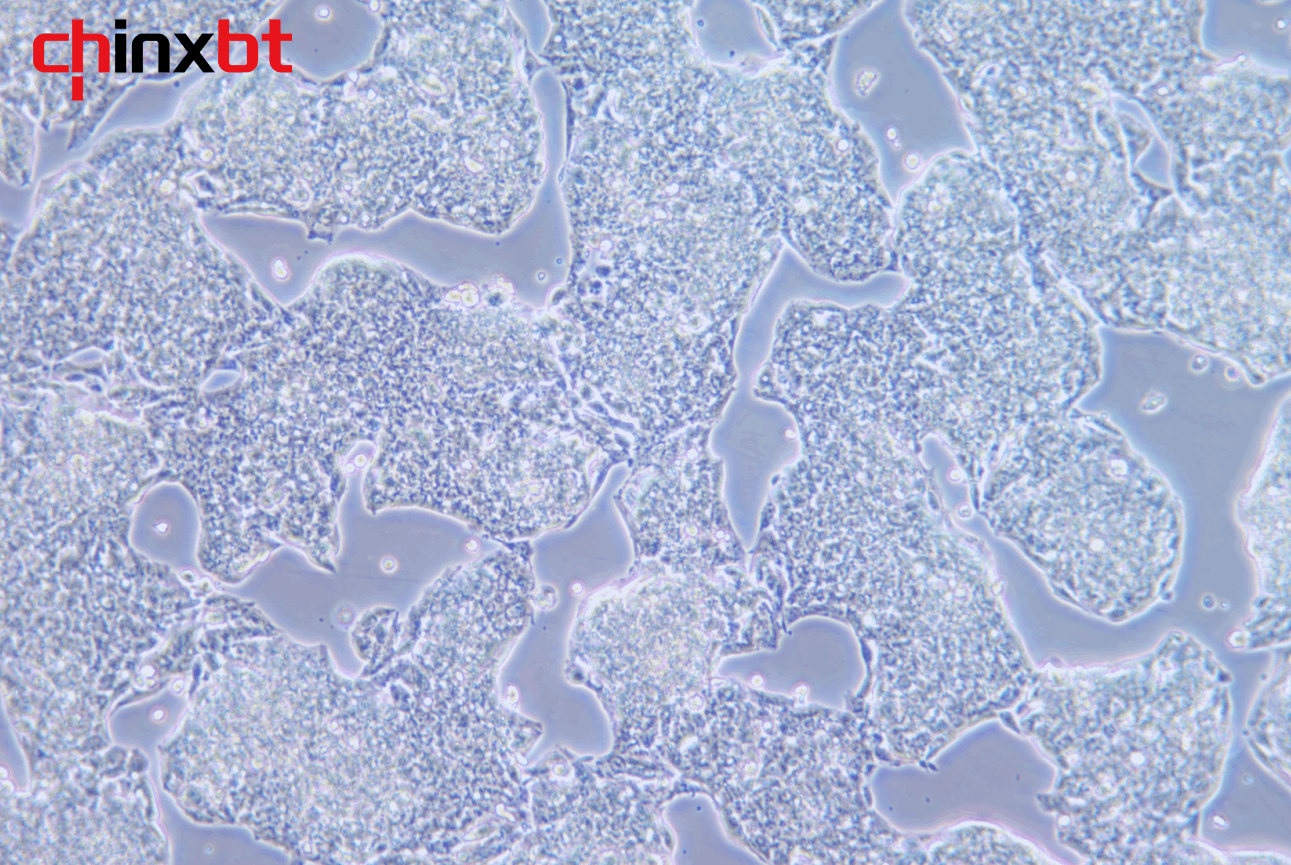 Hep G2 人肝癌细胞_南京中欣博泰生物技术有限公司